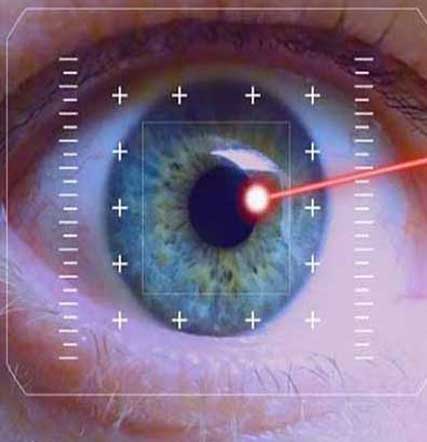 Optometry Services Sydney - Laser Eye Surgery and Retinal Photography